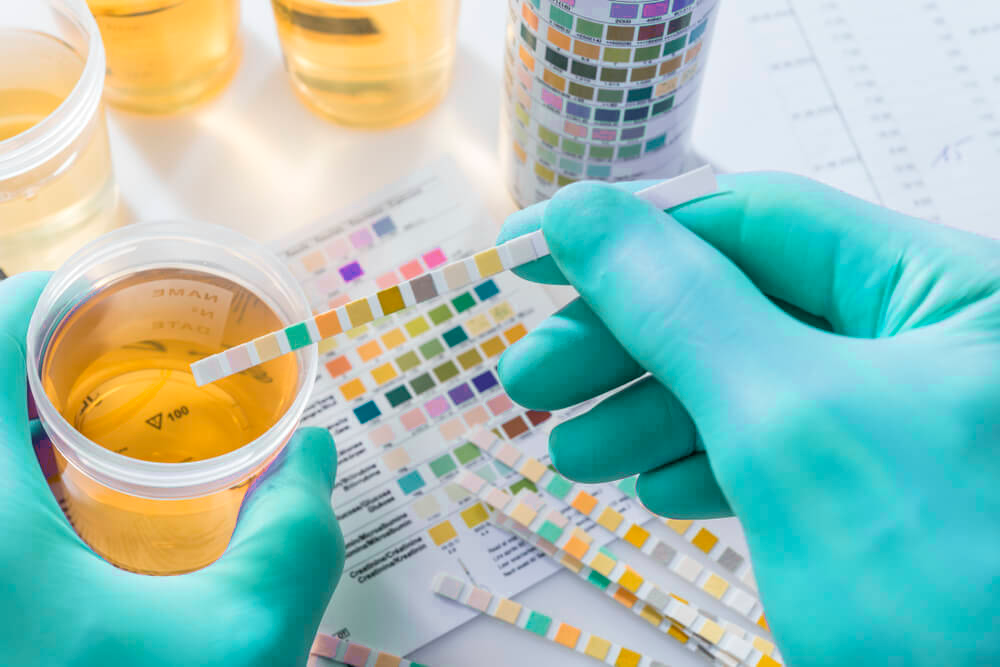 Exame de urocultura: o que é e para que serve. Saiba mais!